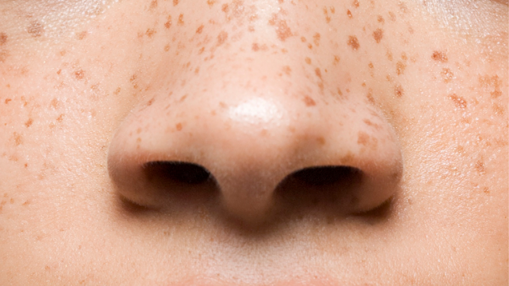 Neusschelpproblemen | Diak Clinic